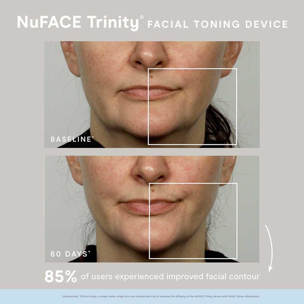 NUFACE Trinity Facial Toning Device Includes 2oz/59 Ml Gel Primer ...